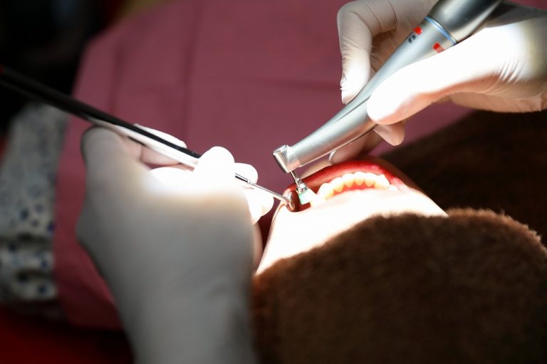 甲府で歯石とり・歯のクリーニング｜PMTC・歯科検診でむし歯や歯周病予防へ｜愛彩デンタルクリニック